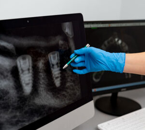 Dr. Ramón Palomero | Clínica Dental Pamplona